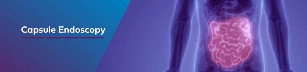Harford Gastroenterology Associates | Capsule Endoscopy - Harford ...